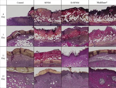 Observation Of Elastic Tissue Recovery By Elastic Verhoeffs Van Gieson