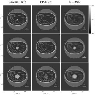 PDF A Deep Neural Networks Based Sound Speed Reconstruction With Enhanced Generalization By