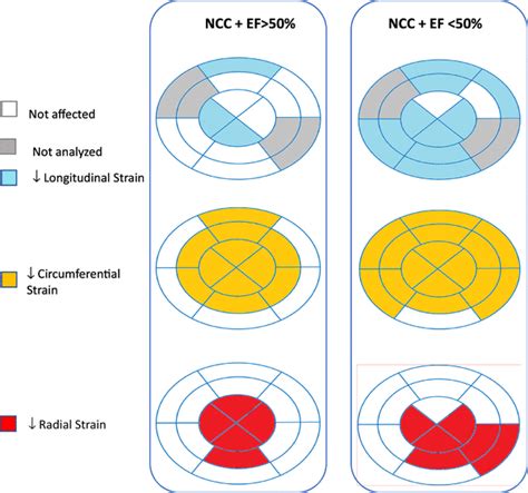 Diagram Showing 16 Segment Model Of Lv Representing The Segmental