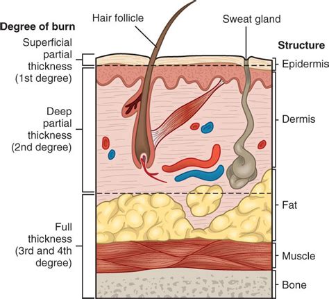 Elsevier Sweat Gland Dermis Epidermis