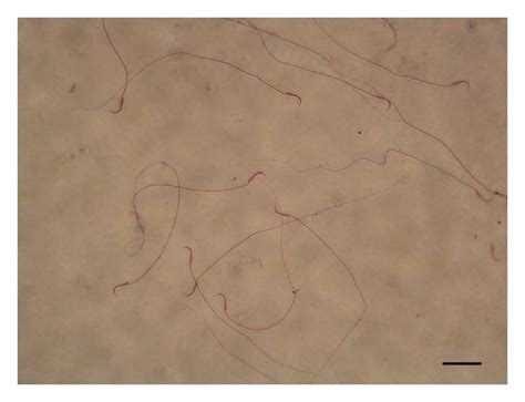 Diff Quick Staining Of Sperm Cells A Sperm Cells Isolated From Diff Quick Staining Of Sperm Cells A Sperm Cells Isolated From