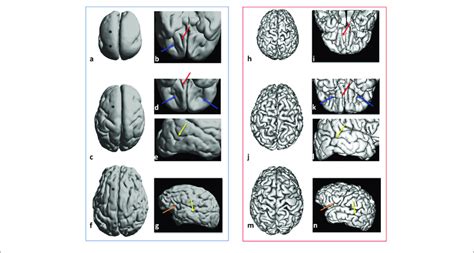 Three Dimensional Views Of Cortical Surface Reconstruction Of Three Download Scientific