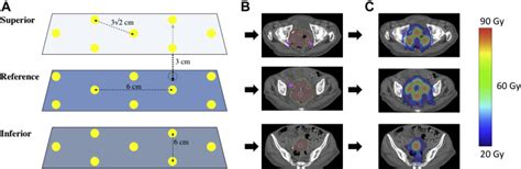 Spatially Fractionated Stereotactic Body Radiation Therapy Lattice