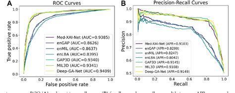 Figure 4 From Deep Ga Net For Accurate And Explainable Detection Of Geographic Atrophy On Oct
