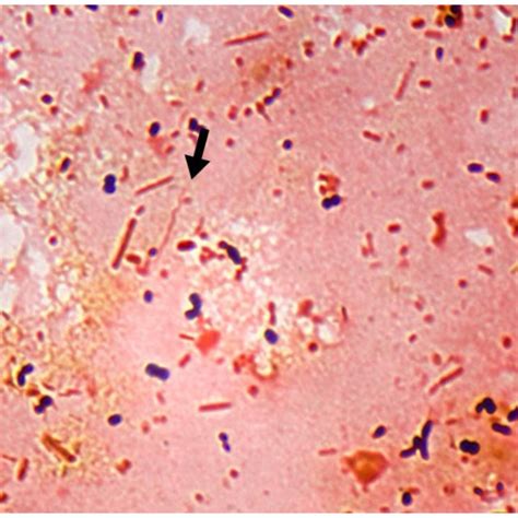Pdf Digital Dermatitis In Cattle Current Bacterial And Immunological