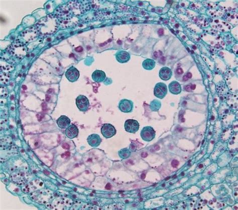 Microscopic Microspores