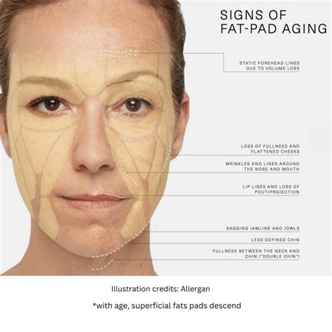 Understanding The Anatomy Of Facial Aging Improves Natural Results