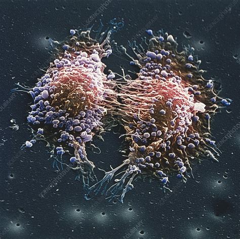 Cancer Cell Division Stock Image M8650172 Science Photo Library