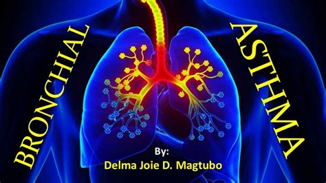 Asthma Ppt