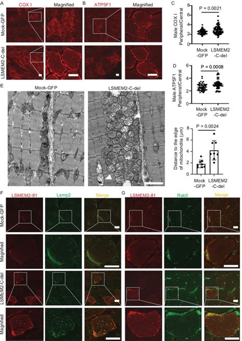 Lsmem2 Localized At The Neuromuscular Junction Modulates Mitochondrial Integration In Skeletal