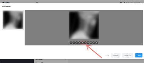 AdvaPACS DICOM Viewer AdvaPACS Docs