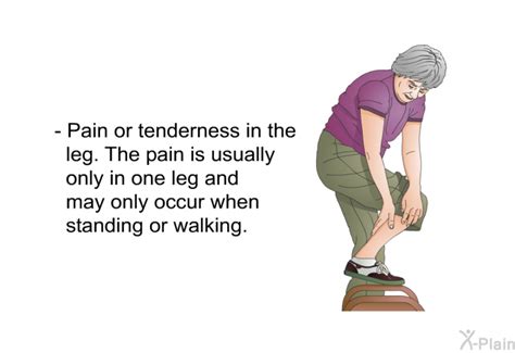 Preventing Deep Vein Thrombosis