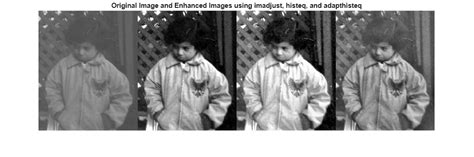 Contrast Enhancement Techniques Matlab And Simulink