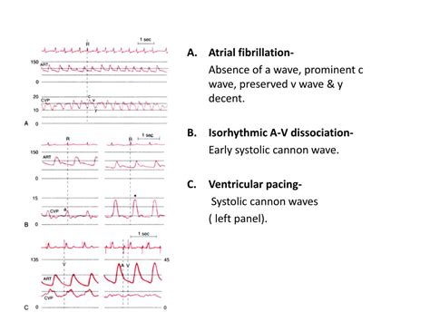 Ppt Cvp Measurement Iii Powerpoint Presentation Free Download Id