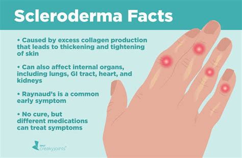 Complications Of Scleroderma Medizzy