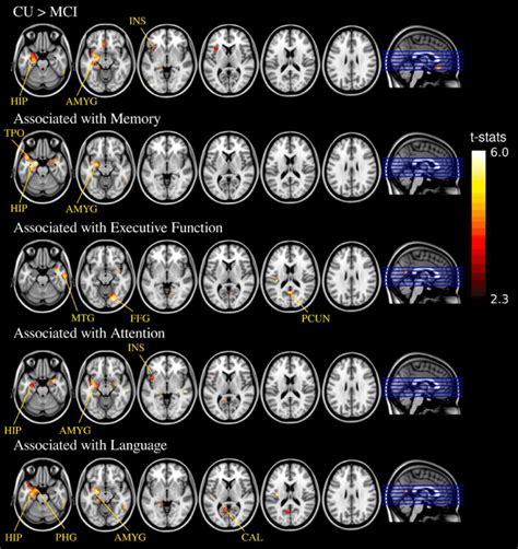 Voxel Wise Analysis Tfce Corrected P