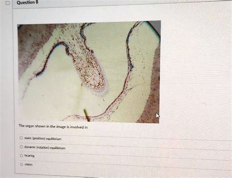 Solved The Organ Shown In The Image Is Involved In Static Position Equilibrium Dynamic