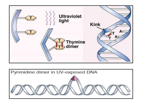 Xeroderma Pigmentosum