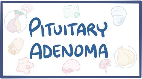 Adenoids Definition