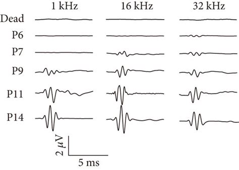 Effects Of Acoustic Stimulation On Abr Responses At Different Postnatal
