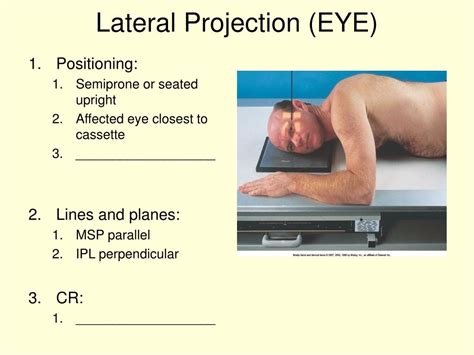 Ppt Radiography Of The Orbits Powerpoint Presentation Free Download