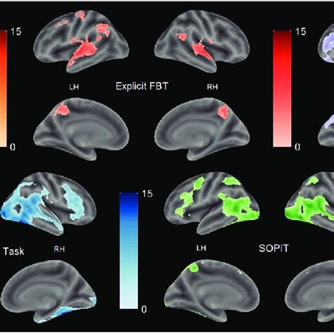Results Of Whole Brain Analysis The Figure Presents Active Areas For