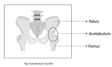 The Acetabulum Is A Socket For Which Bone Class 11 Biology Icse