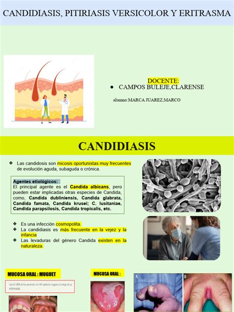Candidiasis Pitiriasis V Eritrasma Descargar Gratis Pdf Candida