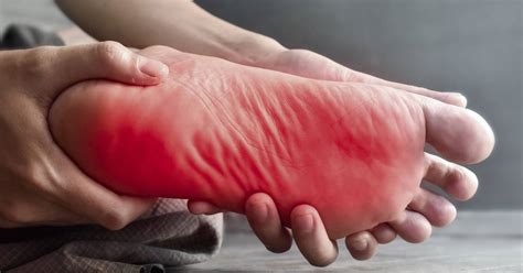 Managing Neuropathies Taste For Life