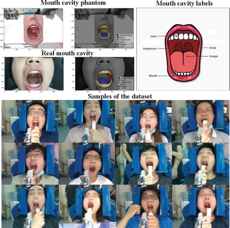 Figure 1 From A Lightweight Deep Learning Network For Mouth Cavity Object Visual Detection