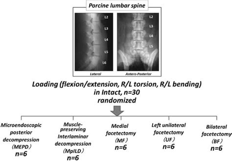 Partial Facetectomy