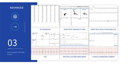 Dynamic Electrocardiogramshenzhen One Heart On Medical Intelligent