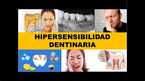 Hipersensibilidad Dentinaria Youtube