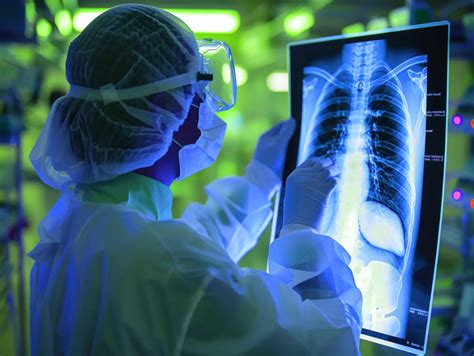 X Ray Computer Troubleshooting And Repair Simons X Ray