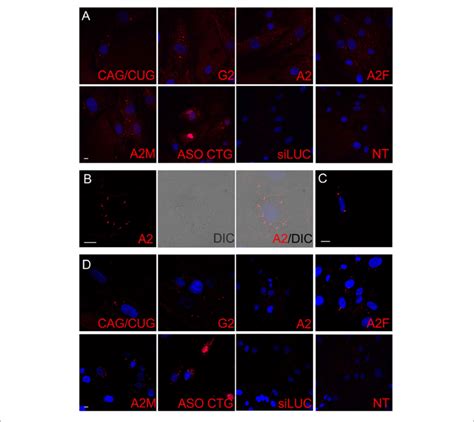 Localization Of Sirnas And Asos Targeting Cag Repeat Tract In Download Scientific Diagram