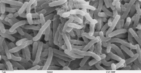 Timeline Germ Theory