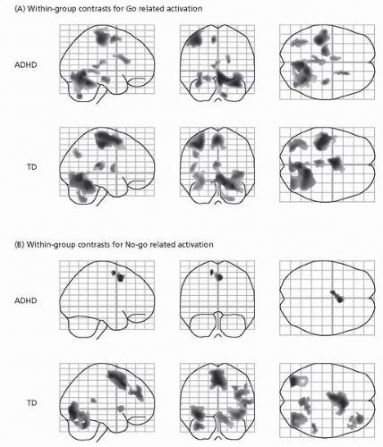 Functional Neuroimaging In Pediatric Populations Neupsy Key