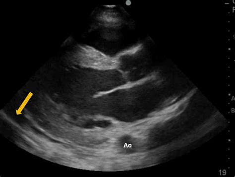 Case Study Limited Cardiac Exam Case Studies