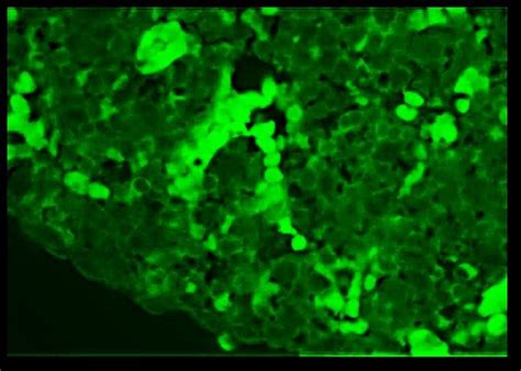 The Section Of Mouse Liver Embryo At The Day 18 Showed Positive