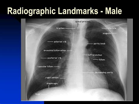 Ppt Understanding Cardiac Imaging Powerpoint Presentation Free