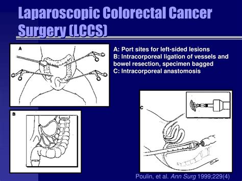 Ppt Laparoscopic Vs Conventional Resections For Colorectal Carcinoma Powerpoint Presentation