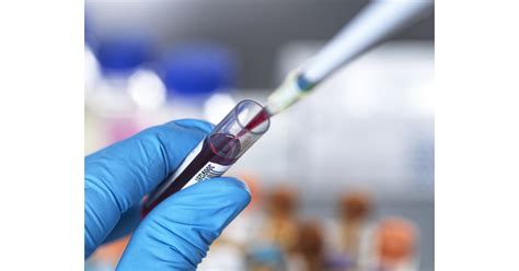 Labcorp Launches Molecular Residual Disease And Liquid Biopsy Solutions