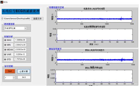 【心电信号】基于matlab Gui心电信号数字滤波处理【含matlab源码 1067期】matlab心电信号滤波 Csdn博客