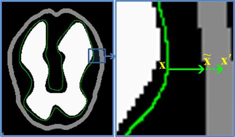 The Condition That Constrains The Development Of Cortex When Cortex Download Scientific