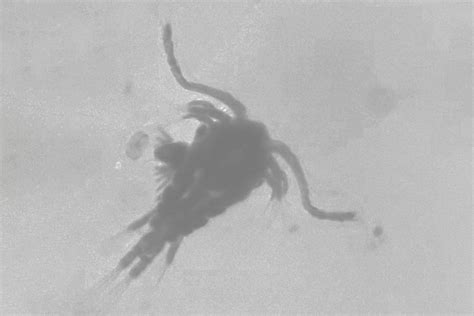 Zooplankton Present In Freshwater Do Not Clean Contaminated Water