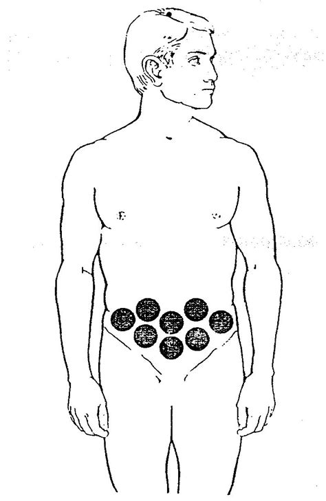 بادکش درمانی پوبیس آبان من