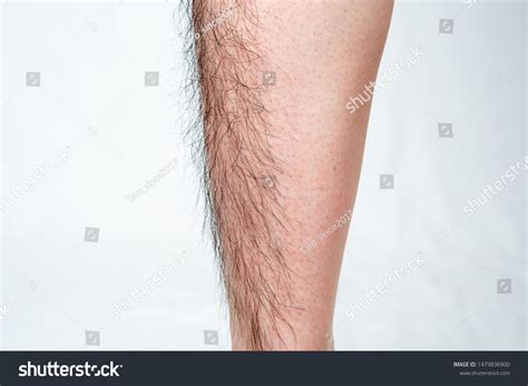 Legs Hair Removal Men Before After Stock Photo Shutterstock