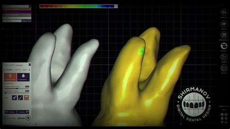 Exocad Modeling 26th Tooth Youtube Music