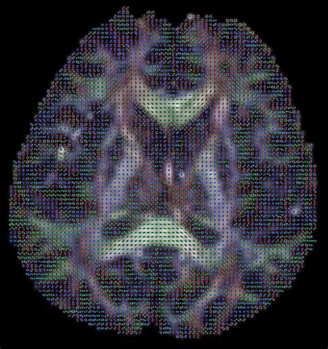 MRI Image Analysis On A Raspberry Pi Piday Raspberrypi Raspberry Pi Adafruit Industries