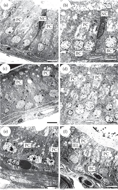 4 Tem Of Mouse Epididymal Epithelim A Initial Segment B Download Scientific Diagram